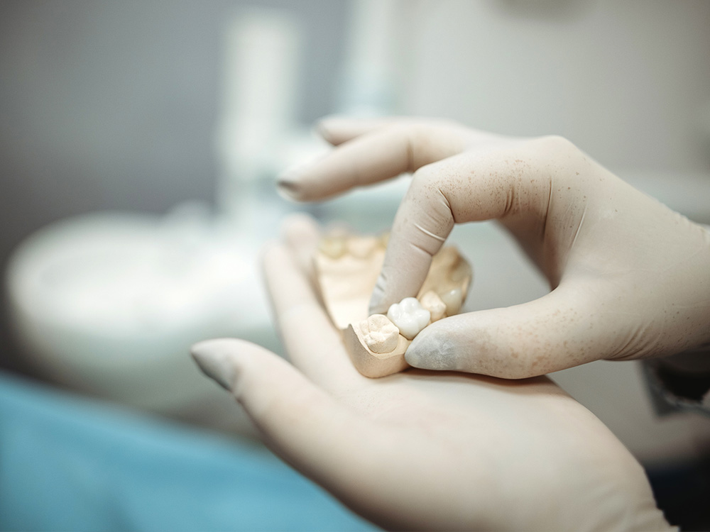 Facings Amsterdam – Tandarts Morshedi