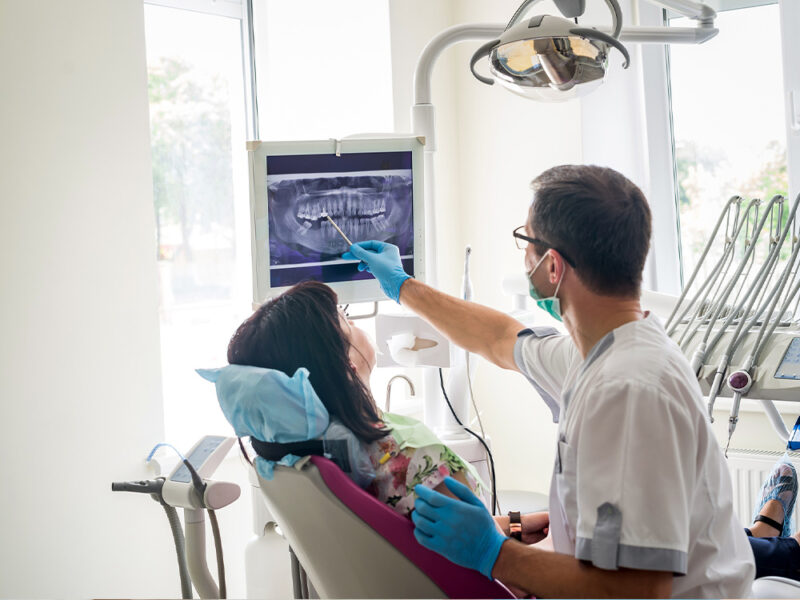 Non-prep facings laten zetten? – Tandarts Morshedi